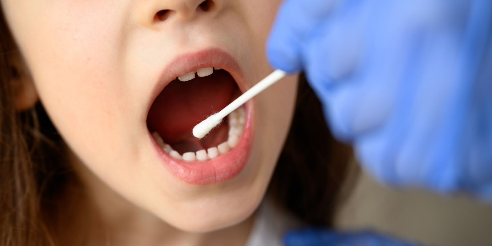 cCMV Infection: Successful Implementation of Pooled Saliva Tests - BFHU